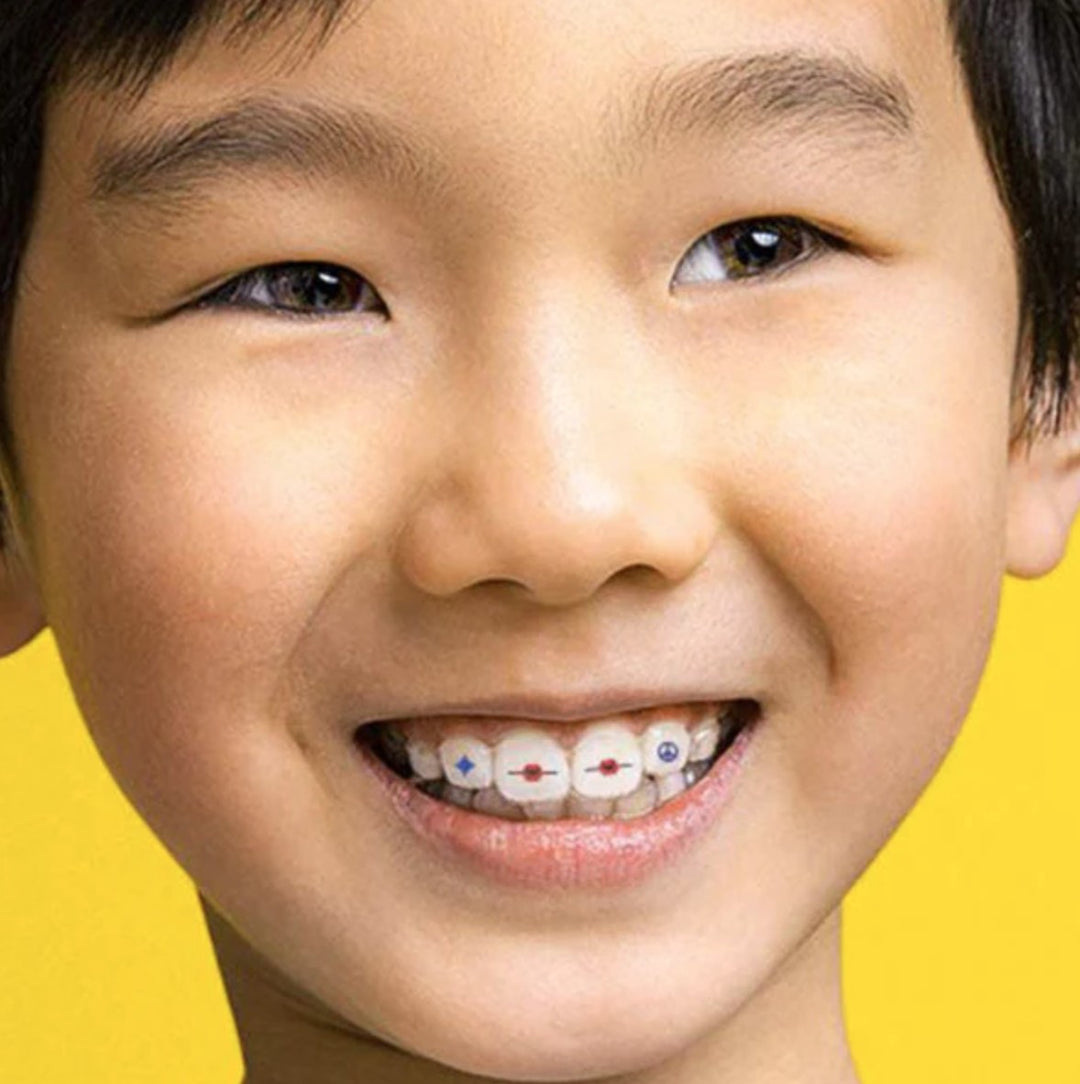 Invisalign France – Invisalign Accessory Store Europe